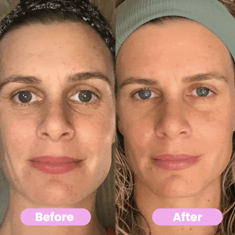 LUMINESCE 7-in-1 LED Facial Sculptor - LUMINESCE